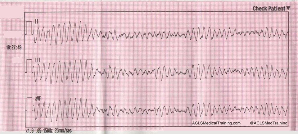 2015 AHA ECC Guidelines – Part 2 - ACLS Medical Training